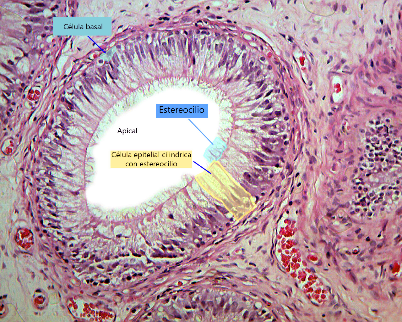 epidídimo epitelio cilíndrico pseudoestratificado con estereocilio ...